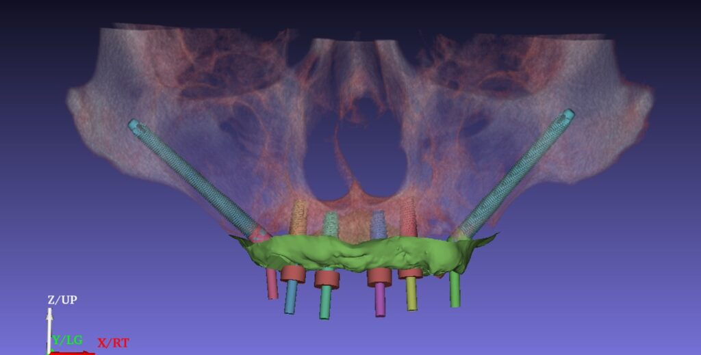 Orthodontics Software – GuideMia