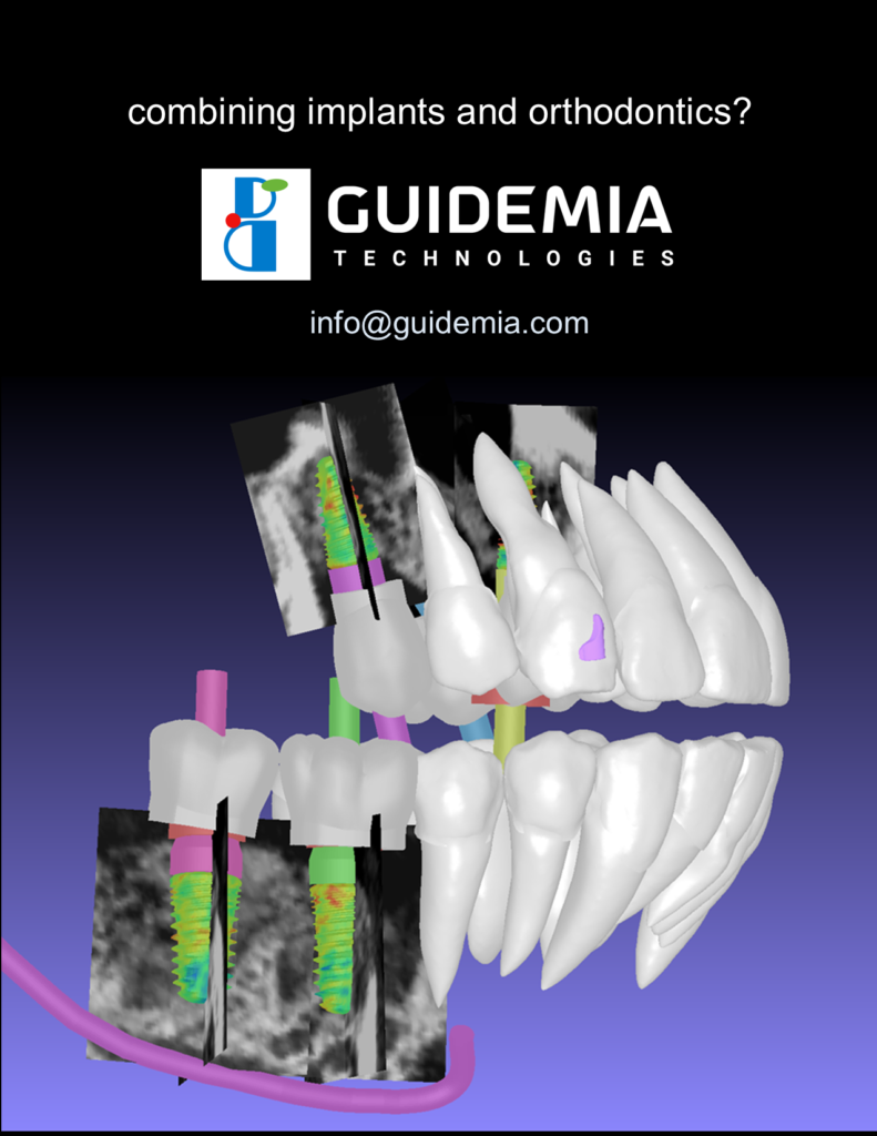 Orthodontics Software – GuideMia